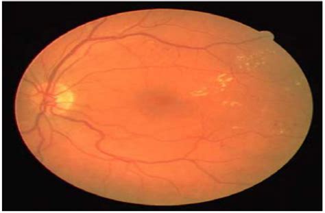 Electronics Free Full Text An Automated Image Segmentation And Useful Feature Extraction