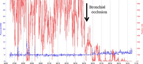 This Chart Shows The Decrease In Air Leakage And The Level Of Suction