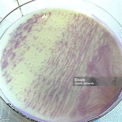 Vancomycin Resistant Enterococci Grown On Chromogenic Agar The Pink