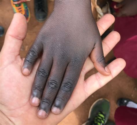 El Tenis Español Obra El Milagro Slima