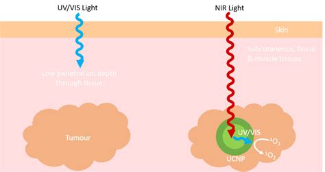 Ucnp For Photodynamic Therapy Treatment Of Tumors Jacs Highlight
