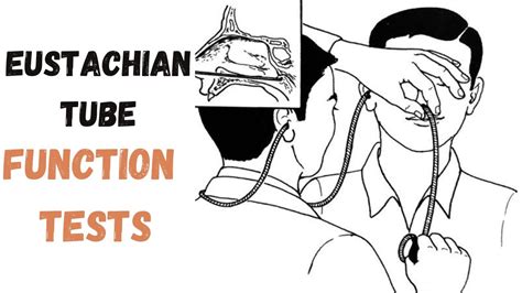 Eustachian Tube Dysfunction Etd Symptoms Treatment