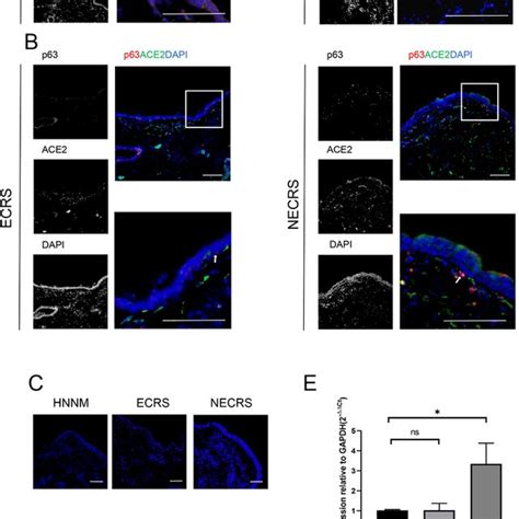 Ace2 Expression Pattern In Human Normal Nasal Mucosa Tissues Hnnm Download Scientific