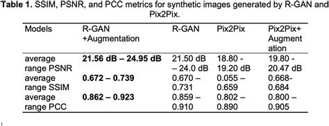 P190 Development Of Synthetic T2 Parametric Maps Using Os Cmr And Novel