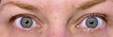 My Eyes Turned Grey At Some Point In The Past Five Years They Were