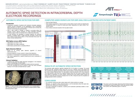 Pdf Automatic Spike Detection In Intracerebral Depth Electrode Recordings