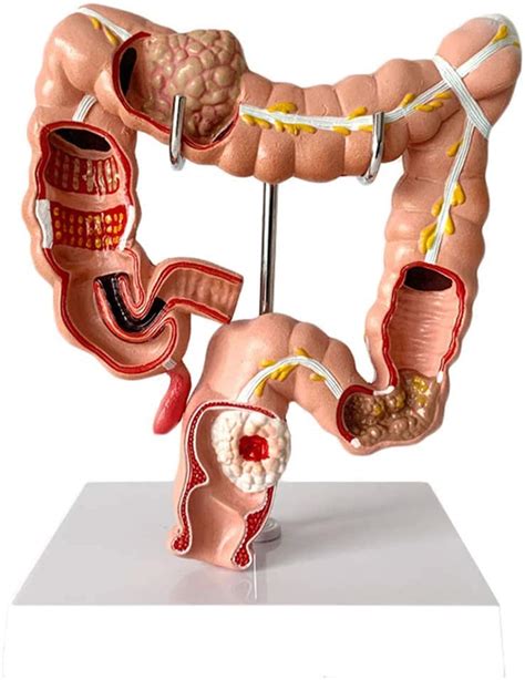 Buy Anatomy Model Human Large Intestine Anatomical Model Colon