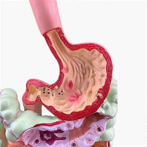 Human Digestive System Model Stomach Anatomy Large Intestine Cecum