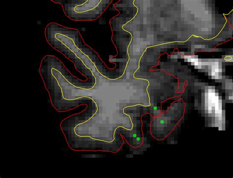 Fstutorialcontrolpointsv60 Free Surfer Wiki