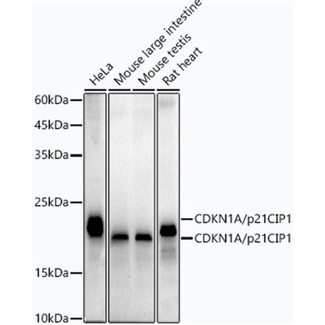 [ko Validated] Cdkn1a P21 Rabbit Mab A19094 Abclonal Ushelf