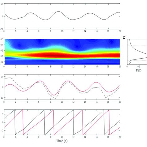 A −d Schematic Of Pleth Modulation Components Due To Respiration Download Scientific Diagram