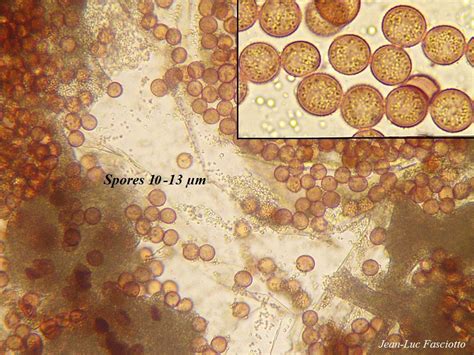 Microscopie Et Champignons Identifiez Les Champignons 20