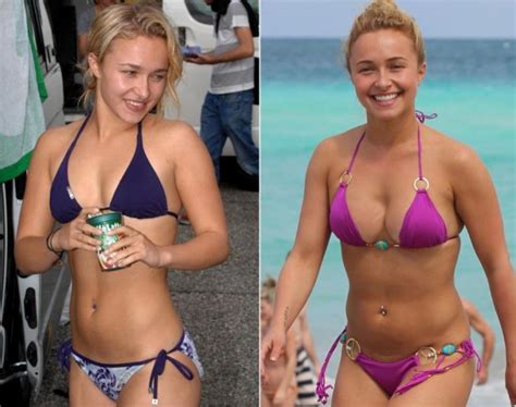 Hayden Panettiere Plastic Surgery Breast Augmentation