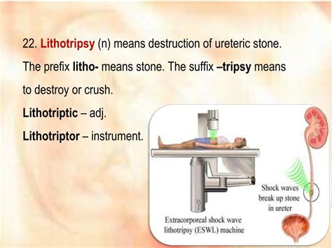 Ppt Understanding The Urinary System Structure Disorders And