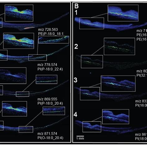 Maldi Ims Shows Complementarity Of Signals In Retina And Rpe A