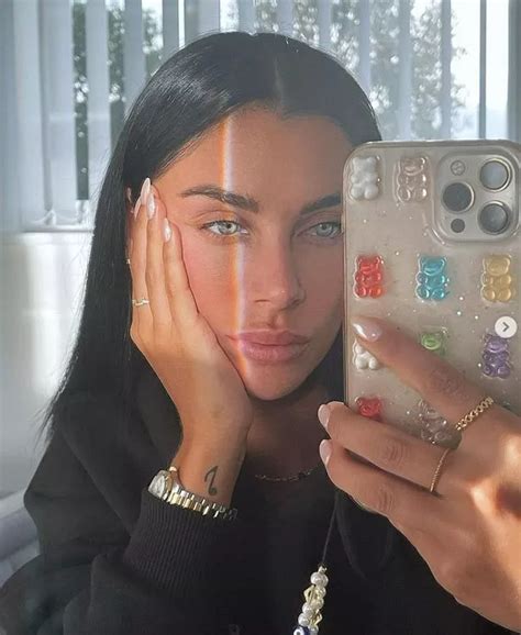 Love Islands Cally Beech Undergoes Sister Surgery Alongside Sister