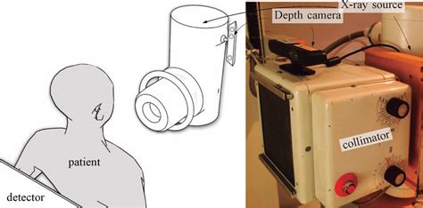 Proposed Augmented X Ray Imaging System Download Scientific Diagram