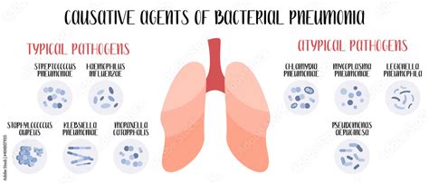 Causative Agents Of Bacterial Pneumonia Acute Respiratory Tract Infections Typical And