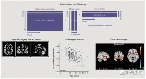 数据驱动方法用于识别健康和疾病中大脑结构和功能之间的联系 Sbm 脑沟深度 Csdn博客