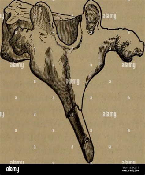 Lateral Displacement Hi Res Stock Photography And Images Alamy