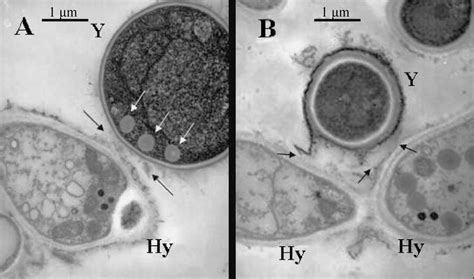 Possible Association Of A Yeast Cell Y With Hyphae Hy Observed By Download Scientific