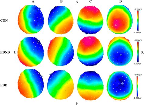 Four Scalp Topographical Template Maps Representing Resting Eeg Download Scientific Diagram