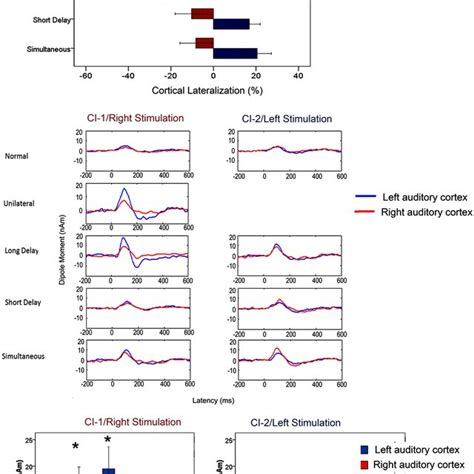 A Example Of An Electrically Evoked Auditory Brainstem Response