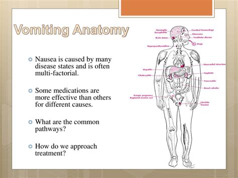 Anatomy Of Vomiting