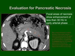 Imaging Acute Pancreatitis Ppt