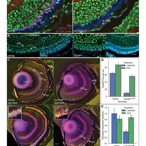 Photoreceptor Outer Segments Os And Tsq To Label Zinc Opl Outer Download Scientific Diagram