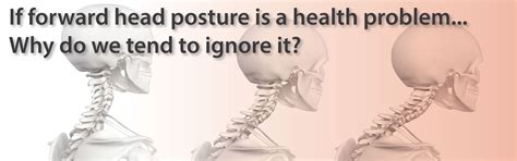 Forward Head Posture Why Its Often Ignored As A Health Issue