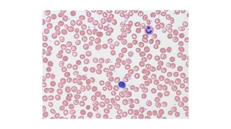 Blood Images Flashcards Quizlet