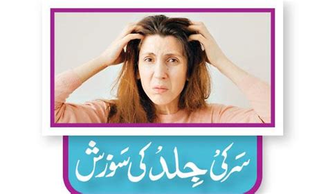 سر کی جلد کی سوزش Weekly Akhbar E Jehan