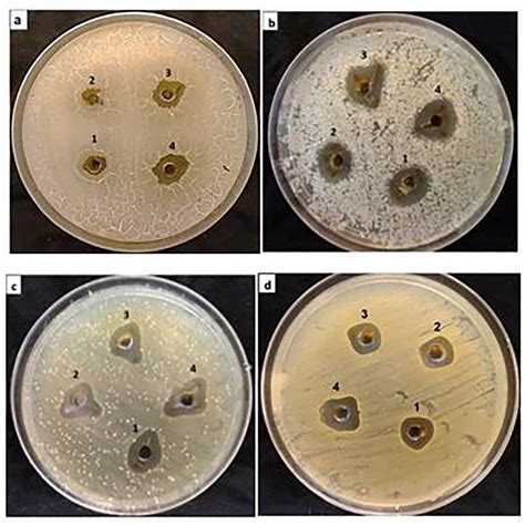Antibacterial Activity Testing Services At ₹ 2000project In Aurangabad