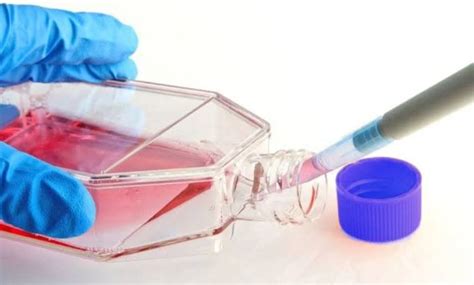 Virology Cellculture Innovation Healthcareresearch Joy Muthoga