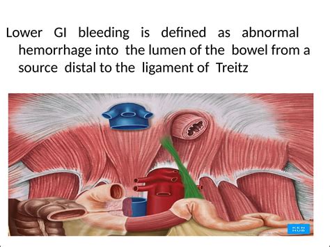 Lower Gi Bleeding And Homoeopathic Therp Pptx