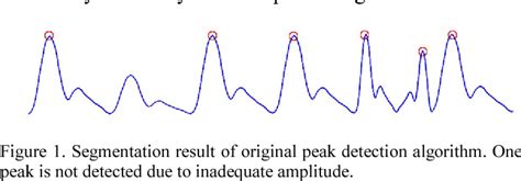 Figure 1 From A Robust Algorithm For Gait Cycle Segmentation Semantic