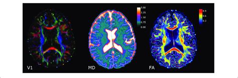 Results Of Diffusion Tensor Imaging Data Processing Single Slice Download Scientific
