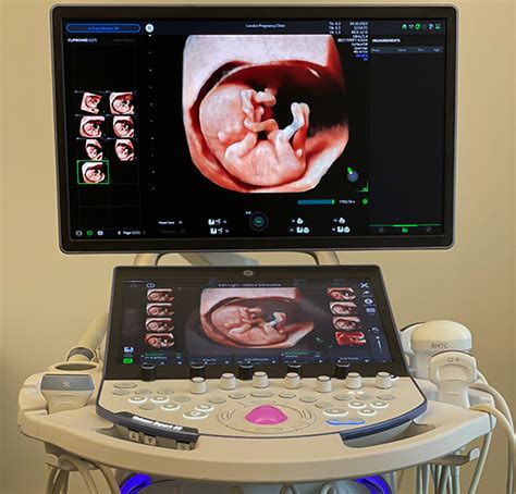 Low Papp A What Does It Mean For My Pregnancy