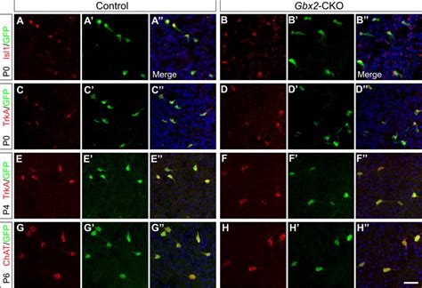 Differentiation Of Striatal Cholinergic Interneurons During Early