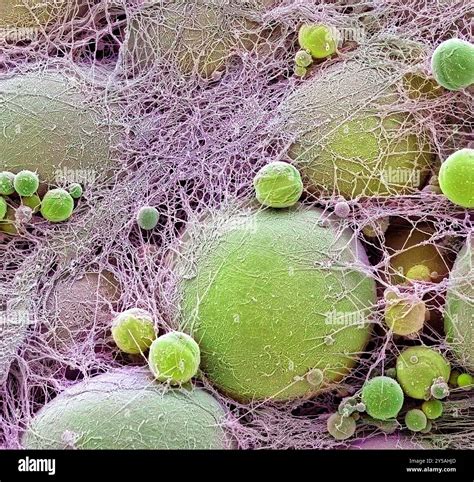Fat Cells Coloured Scanning Electron Micrograph Sem Of Joined Fat