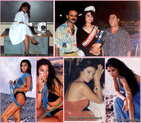 Overdose Celebs Plastic Surgery