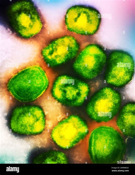 Colorized Transmission Electron Micrograph Of Monkeypox Virus Particles