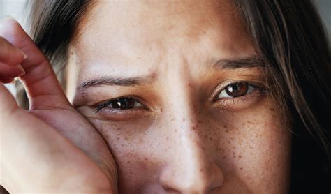 Hematoom En Blauwe Plek Behandeling Boiron