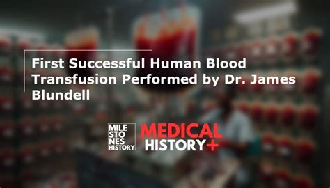 Dr Blundells First Blood Transfusion In 1818 Milestones In Medical