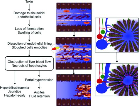 The Pathophysiology Of Sinusoidal Obstruction Syndrome The Presumed Download Scientific