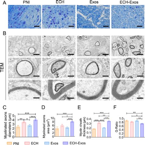 Morphological Assessment Of The Axonal Remyelination Using Tbs And Tem Download Scientific