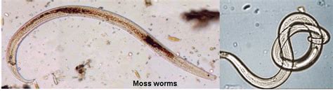 Emergency Kit Of Things To See Or What Can I See With My New Microscope