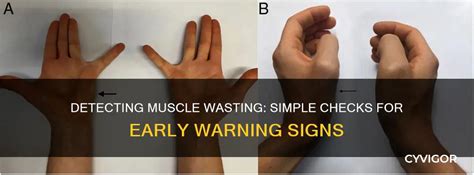Detecting Muscle Wasting Simple Checks For Early Warning Signs Cyvigor