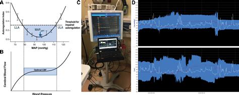 Precision Medicine In Neurocritical Care For Cerebrovascular Disease Cases Stroke